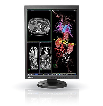 Projector.co.il - חברת המקרנים של ישראל | צג רפואי ''21.3 Eizo ...