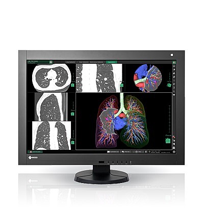 Projector.co.il - חברת המקרנים של ישראל | צג רפואי ''29.8 Eizo ...